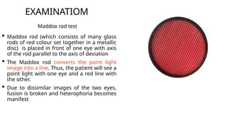 Squint ,types,heterophoria.pptx.......... | PPTX