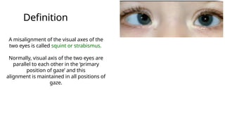 Squint ,types,heterophoria.pptx.......... | PPTX