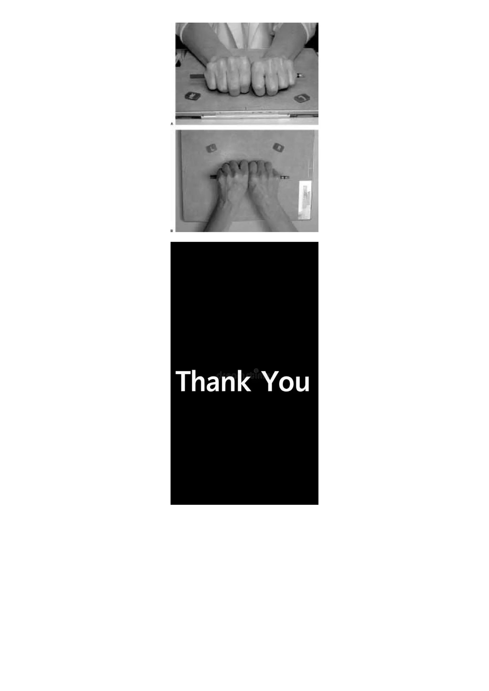 PA View of Hand (Radiography)_20250817_120156_0000.pdf