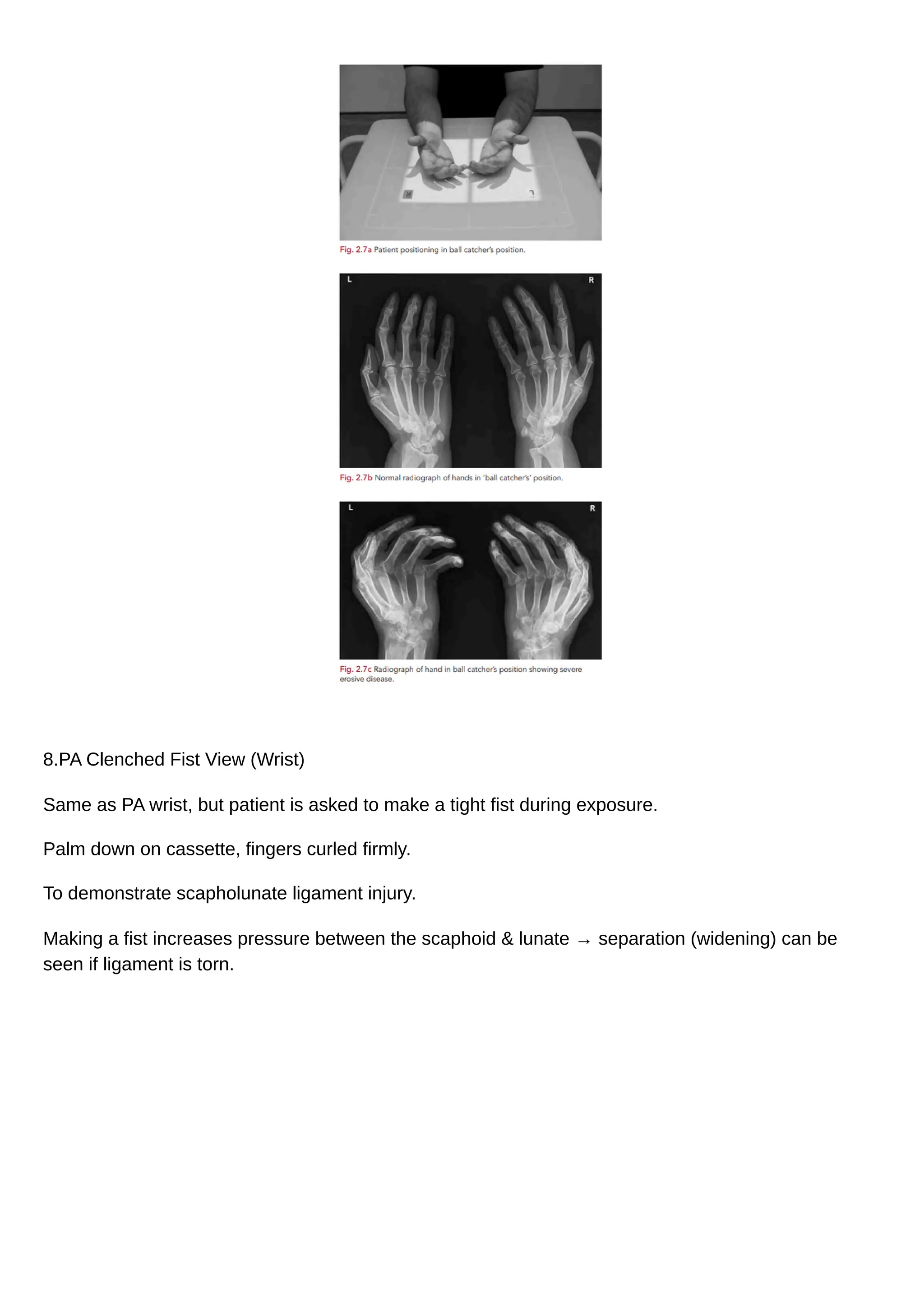 PA View of Hand (Radiography)_20250817_120156_0000.pdf
