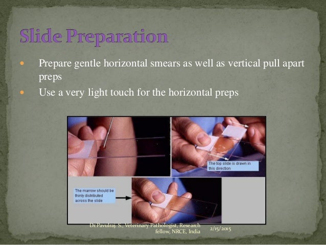 Pavuls presentation bonemarrow aspiration techniques