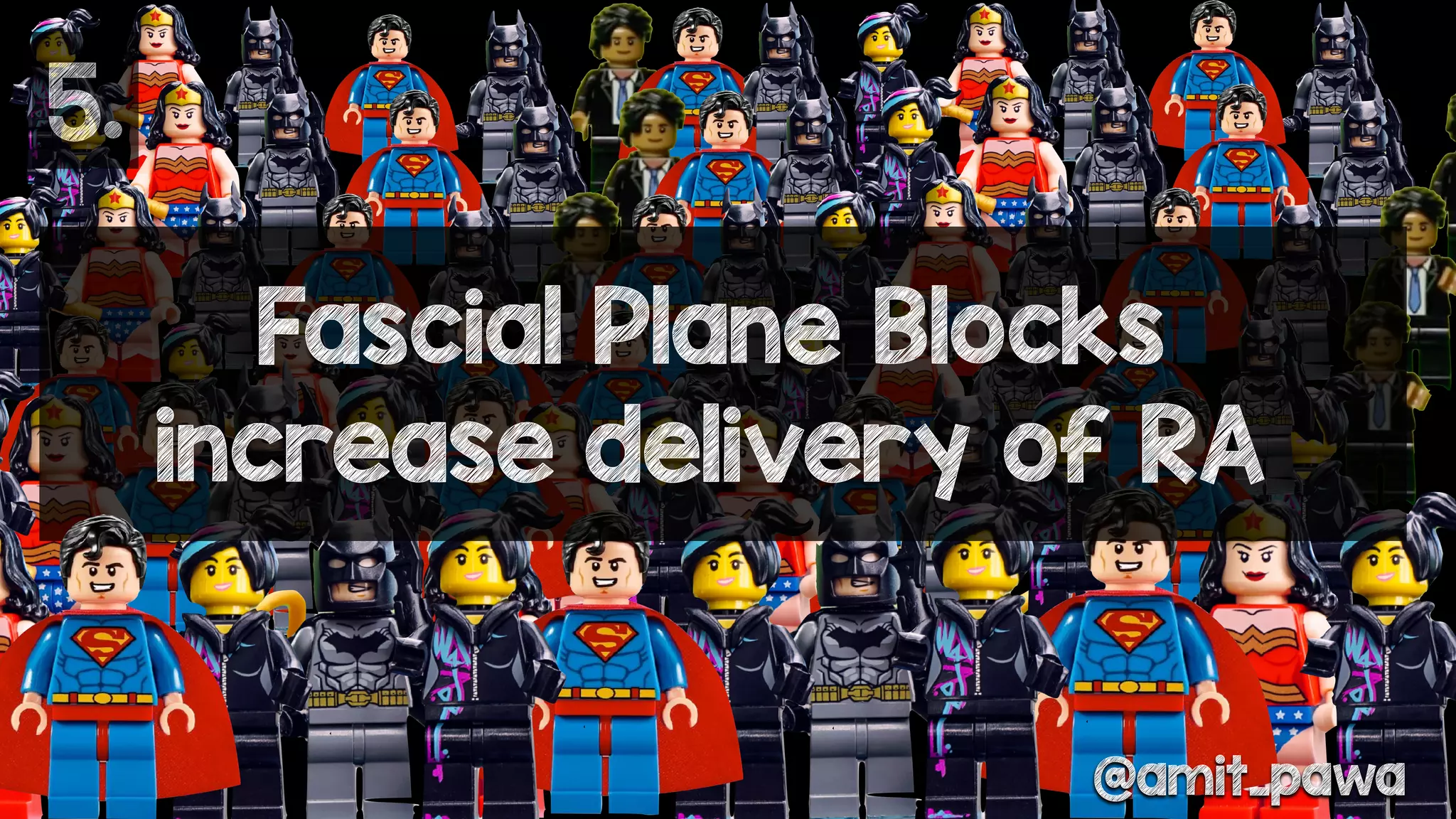 Fascial Plane Blocks - Norwich Anaesthesia Update 2021 pdf | PDF