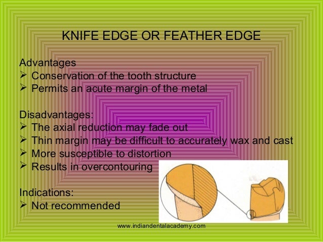 principles of tooth preparation seminar 6