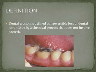 Tooth Abfraction Treatment