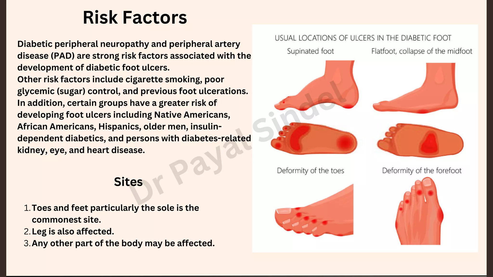 Diabetic foot | PDF