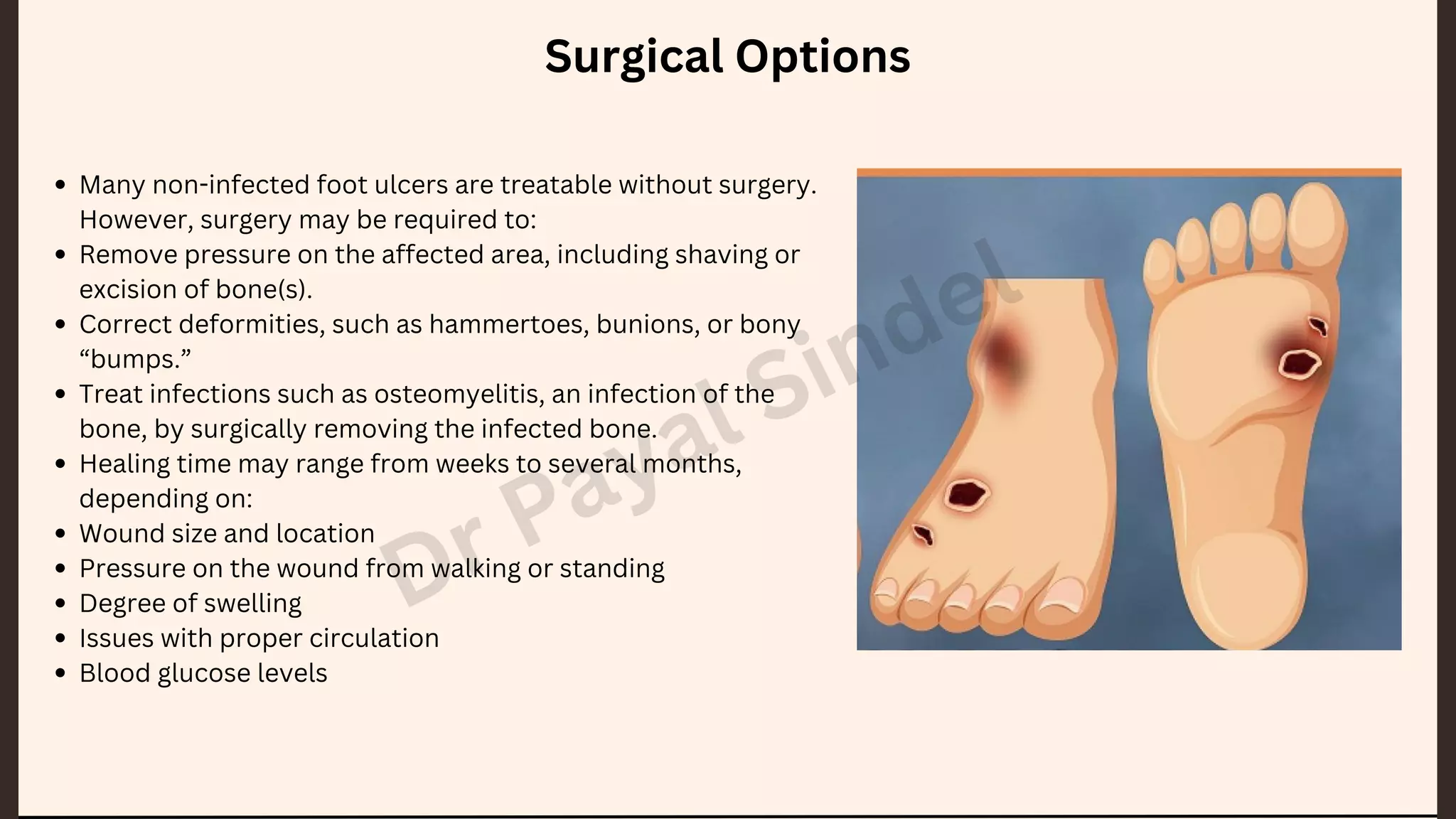 Diabetic foot | PDF