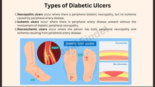 Diabetic foot | PPT