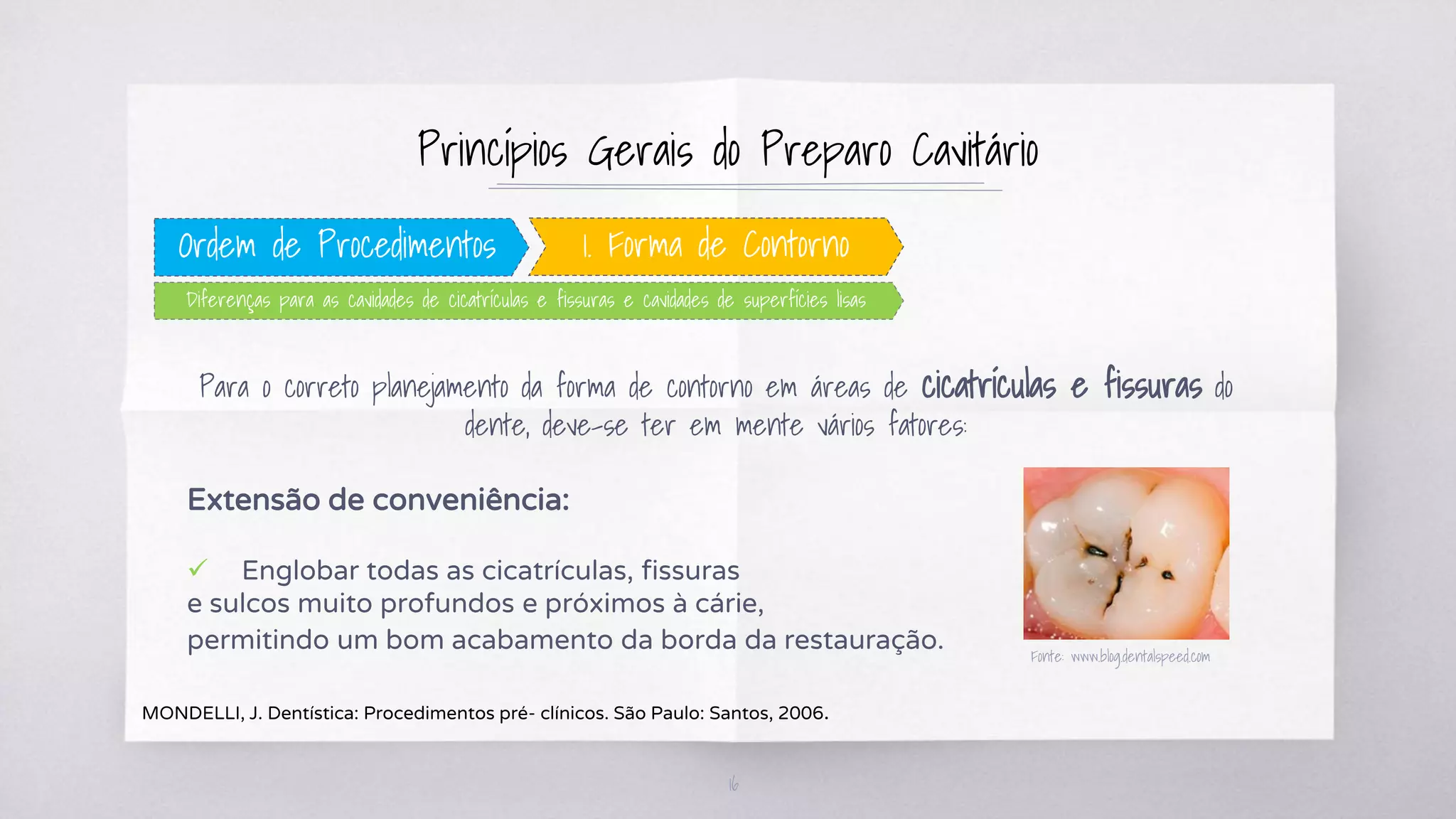 Princípios Gerais do Preparo Cavitário | PDF