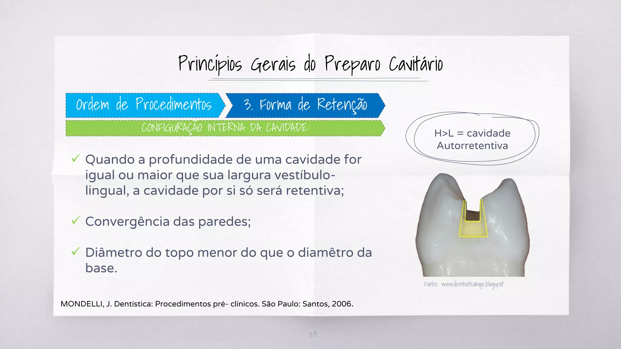 Princípios Gerais do Preparo Cavitário | PDF