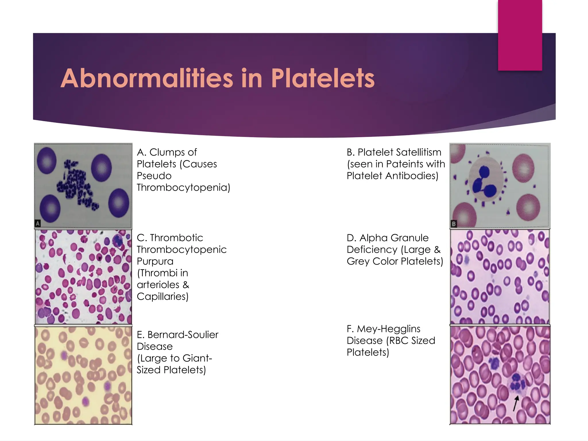 Peripheral Blood Film Preparation, Examination And Interpretation | PPTX