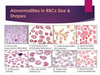 Peripheral Blood Film Preparation, Examination And Interpretation | PPTX