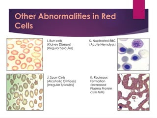Peripheral Blood Film Preparation, Examination And Interpretation | PPTX