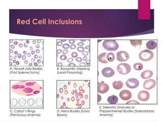 Peripheral Blood Film Preparation, Examination And Interpretation | PPTX