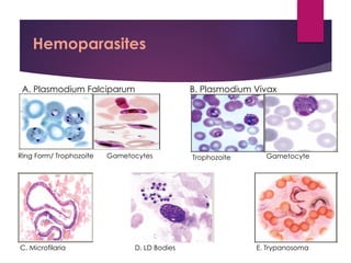 Peripheral Blood Film Preparation, Examination And Interpretation | PPTX