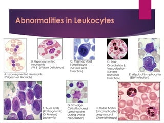 Peripheral Blood Film Preparation, Examination And Interpretation | PPTX