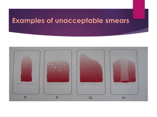 Peripheral Blood Film Preparation, Examination And Interpretation | PPTX