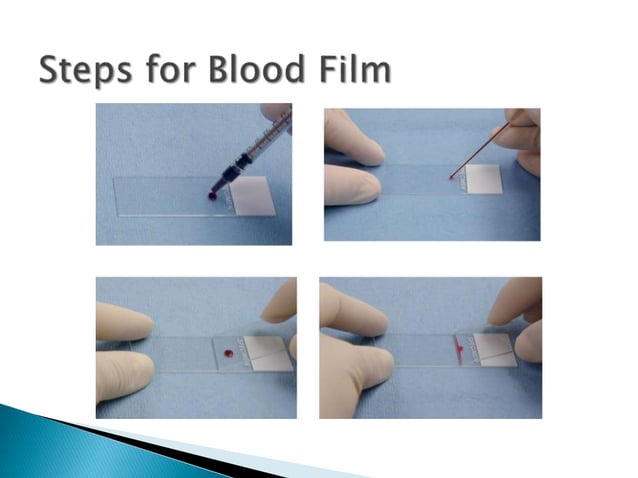 Preparation of peripheral blood flim | PPT