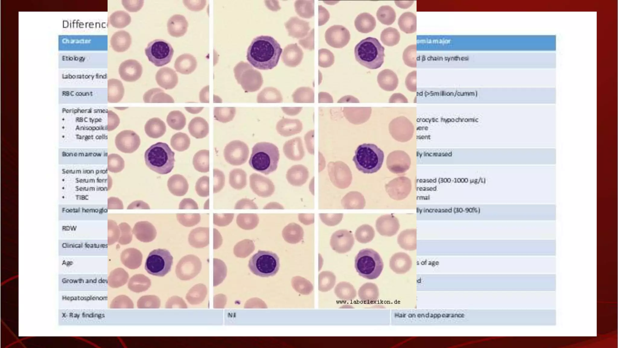 peripheral blood smear spot diagnosis | PPTX
