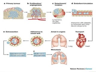malignant and benign tumors , the stages and grading of tumor , type of ...