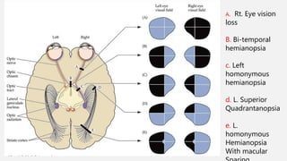 visual pathways | PPTX