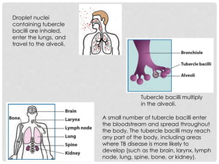 Pbl 2 –pod 1 : the morphology and structure of mycobacterium ...