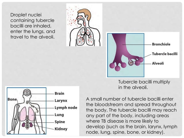 Pbl 2 –pod 1 : the morphology and structure of mycobacterium ...