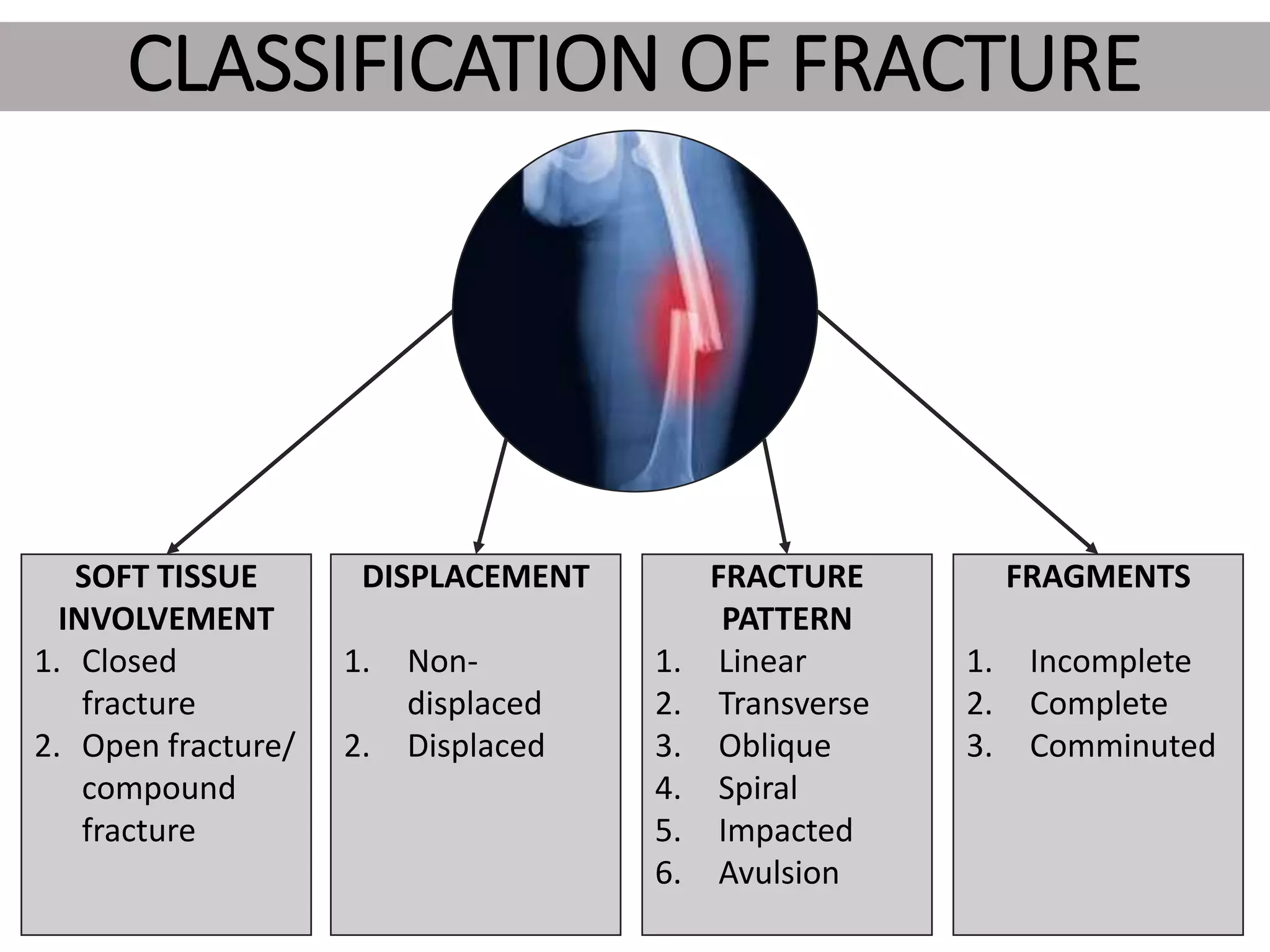 Types of Fractures | PPTX