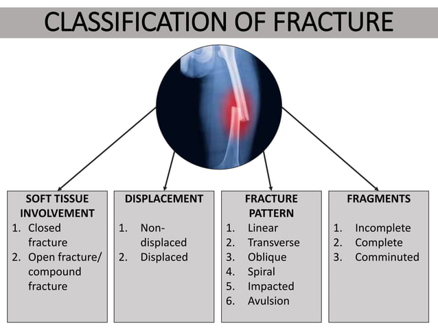 Types of Fractures | PPTX