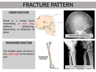 Types of Fractures | PPTX