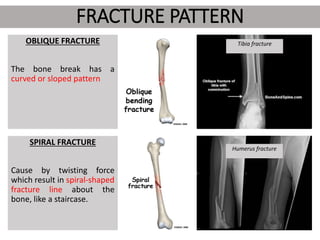 Types of Fractures | PPTX