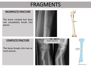 Complete Vs Incomplete Fracture