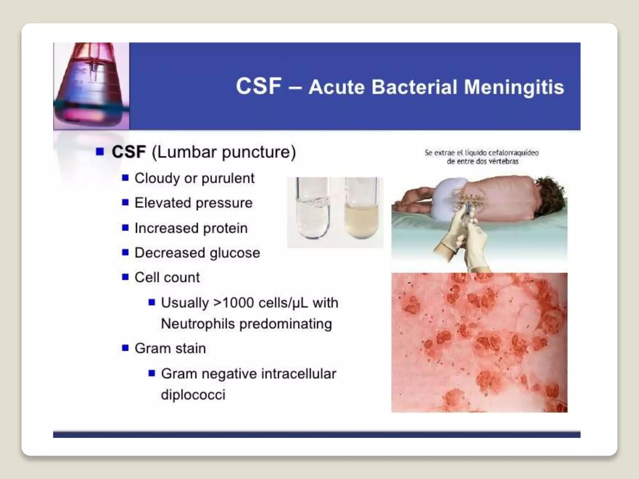 Pbl 3 –pod 1 : the morphology and structure of Neisseria meningitidis ...