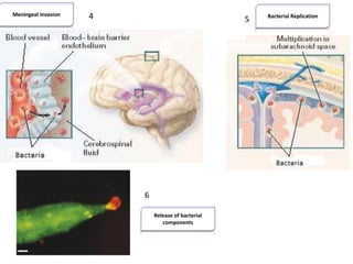 Pbl 3 –pod 1 : the morphology and structure of Neisseria meningitidis ...