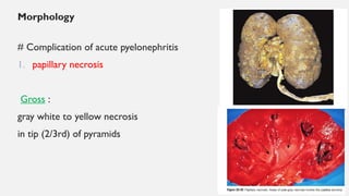 acute pyelonephritis ab. d | PPT | Infectious Diseases | Diseases and ...