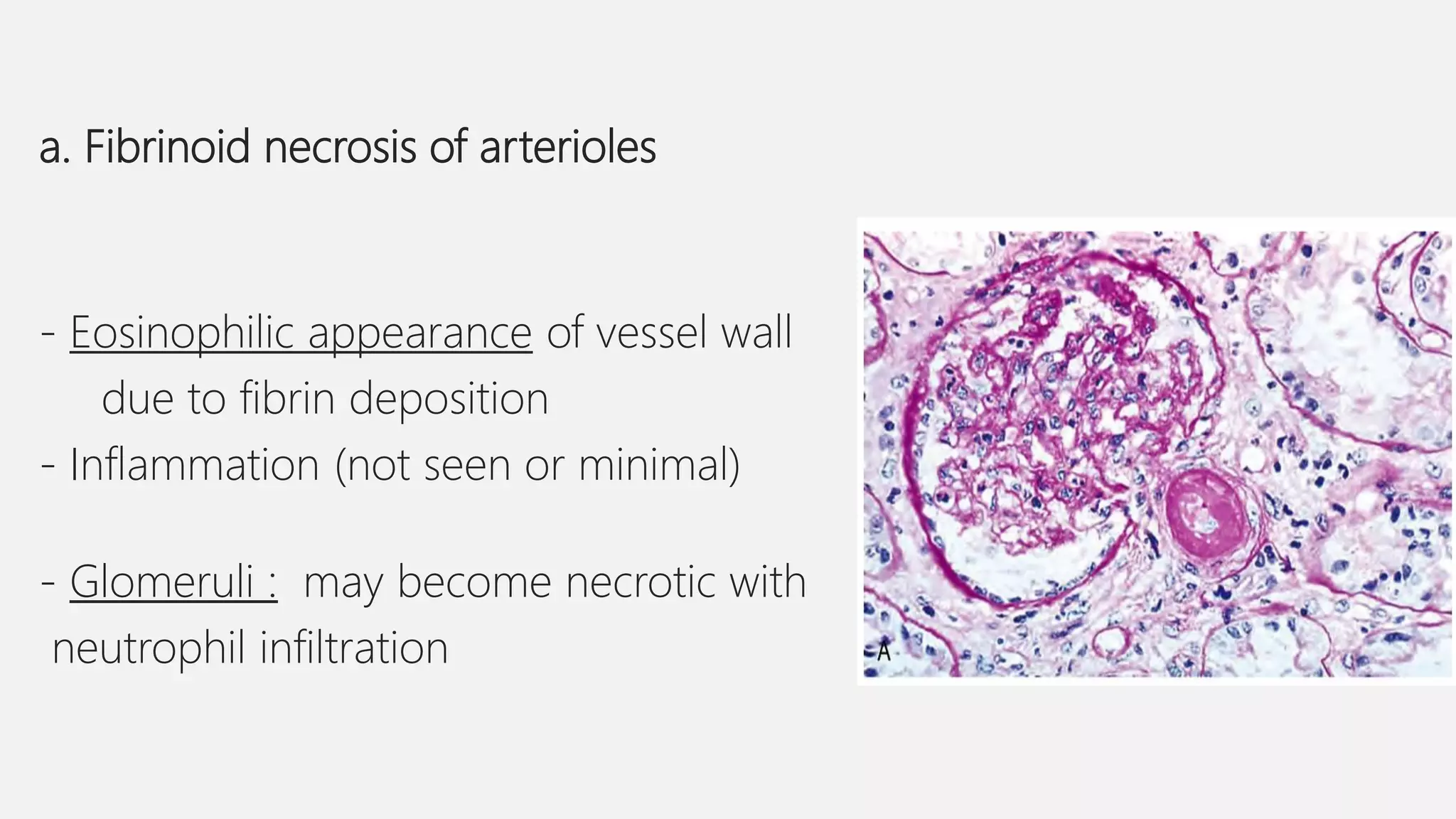 kidney on hypertension | PPTX
