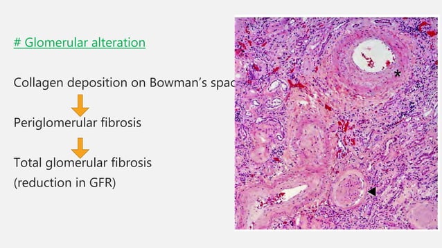 kidney on hypertension | PPT