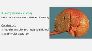kidney on hypertension | PPTX
