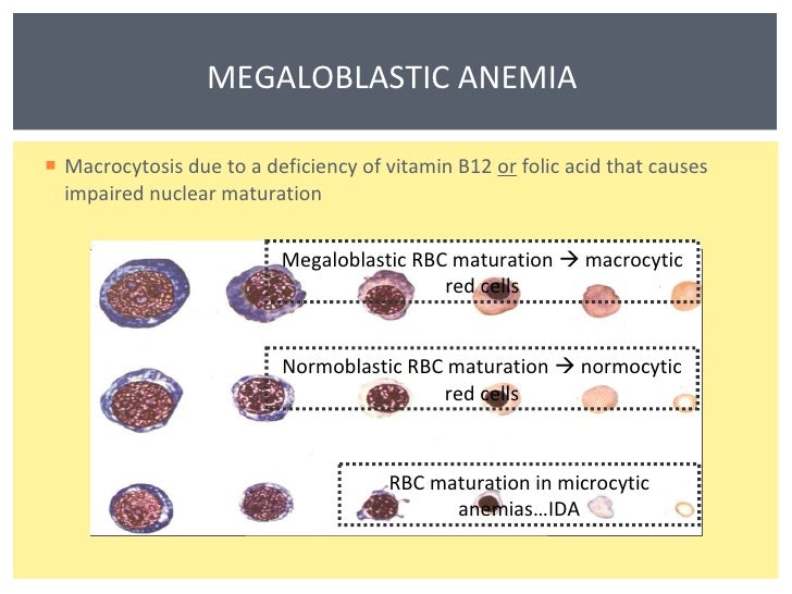 anemia classification