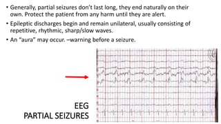 Partial Seizure Eeg