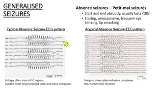 Seizure Eeg