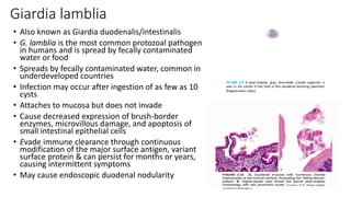 PBL Giardia.pptx