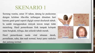 PBL MODUL IMUNOLOGI "BERCAK MERAH" | PPTX