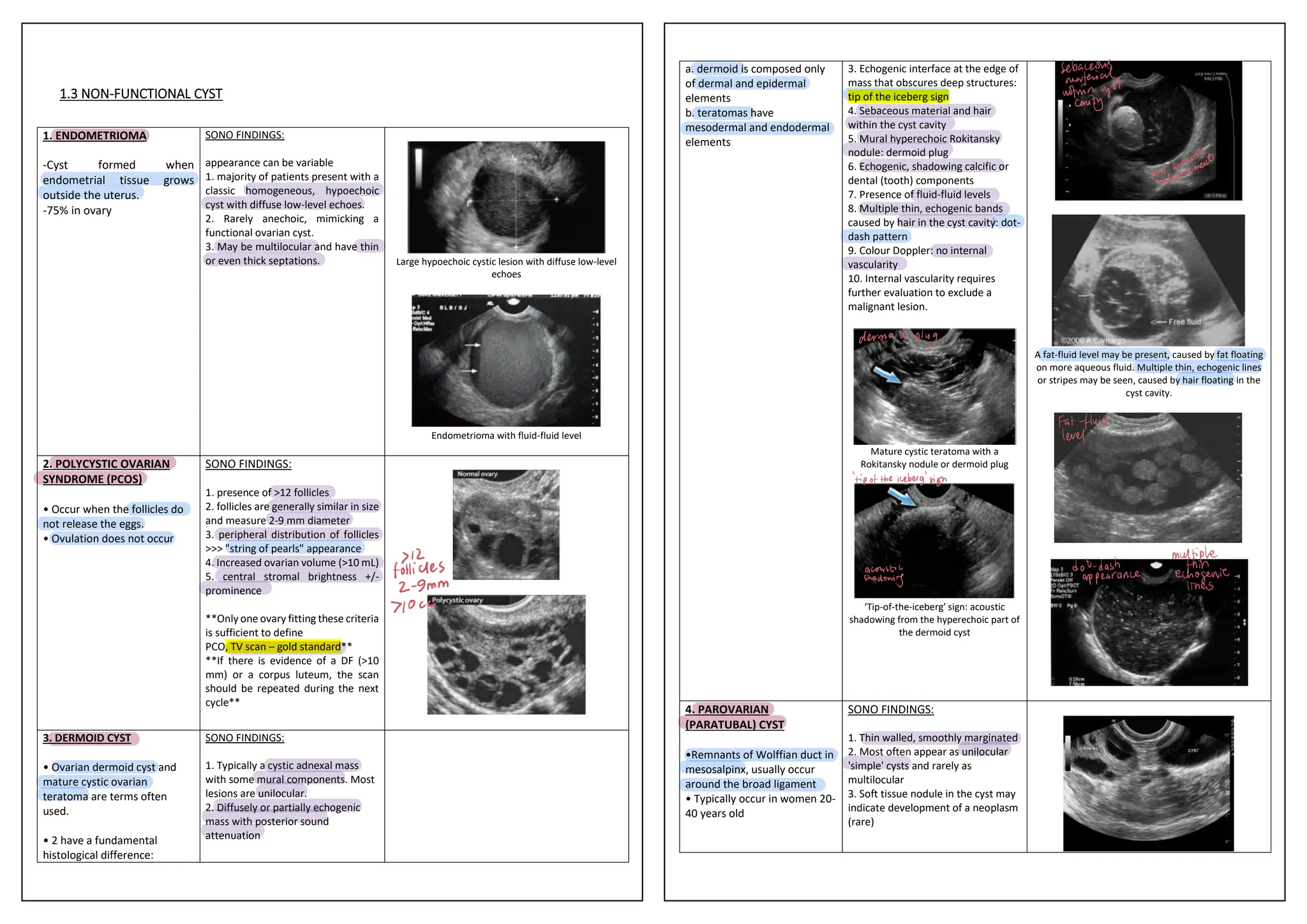 Ovarian pathology short notes quick study | PDF