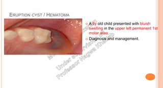 pbl peridontal problems in children.pptx