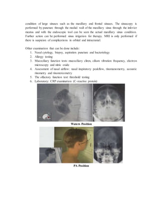 pbl report smelling | DOCX | Ear, Nose and Throat Conditions | Diseases ...