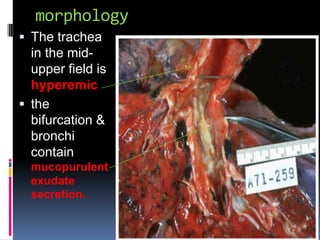 COPD lecture | PPTX