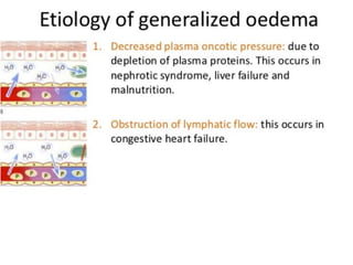 Pathophysiology of generalised edema | PPT