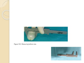 PBMV HARDWARE.pptx | Heart and Cardiovascular Diseases | Diseases and ...