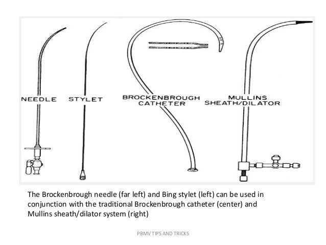 PBMV:Tips and Tricks