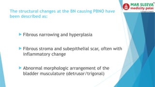 PRIMARY BLADDER NECK OBSTRUCTION MANAGEMENT | PPT